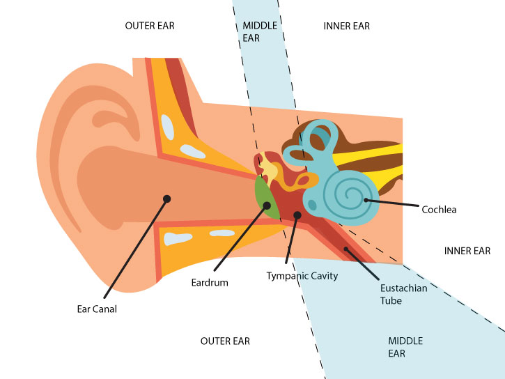 What Is Glue Ear What Is Glue Ear